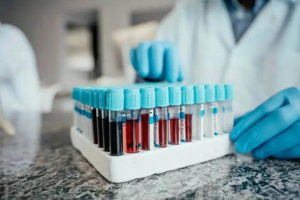 Functional Medicine Blood Tests | Alternative Family Medicine ...